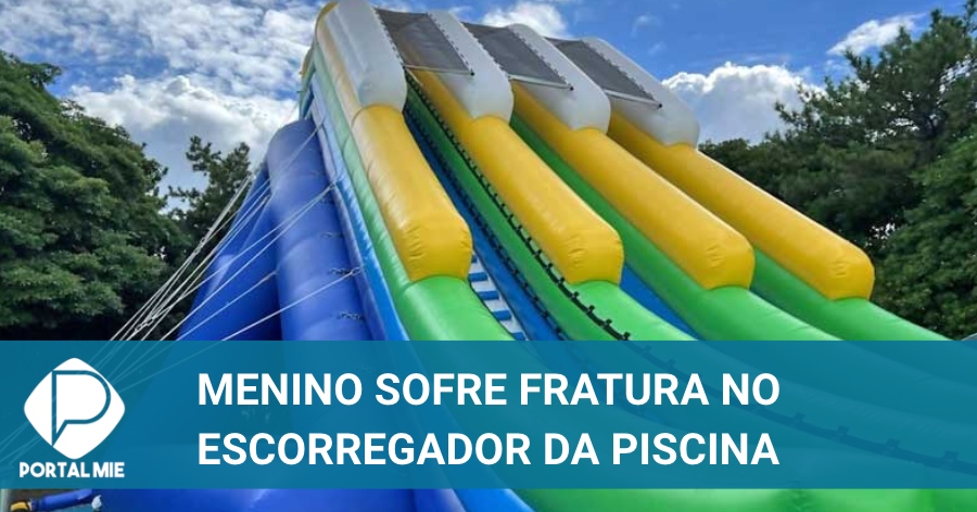 Menino Quebra Perna No Escorregador Da Piscina Portal Mie